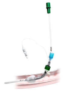 Tracheostomy Cannula Exchange Guide - DEAS Respiratory Solutions